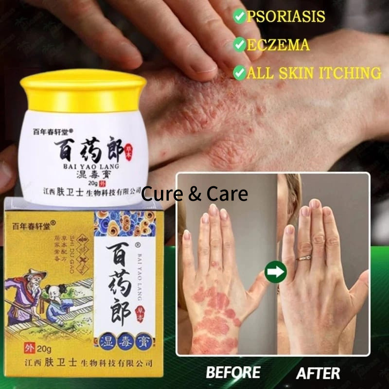 Skin Cream Bai Yao Lang Antibacterial Cream 20g Eczema Gatal Kulit Allergic Skin Itching ...