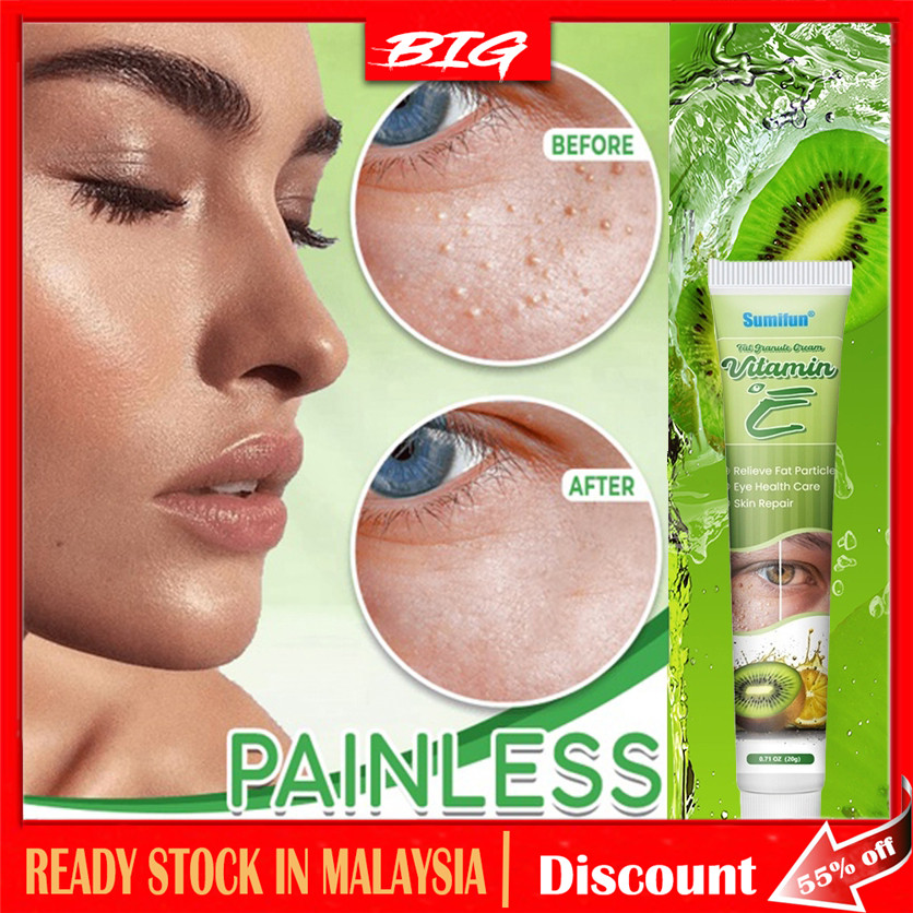 Milia Remover Eye Cream Krim Milia Seed Remover Biji Kolestrol Remover ...