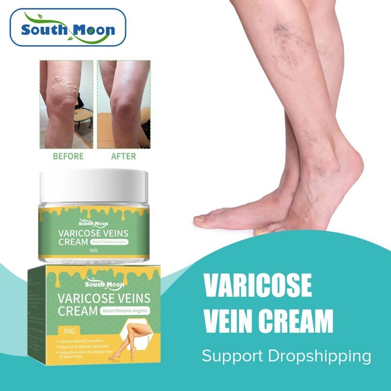 South Moon Varicose Vein Cream Relief Spider Vein Pain Anti Swelling ...