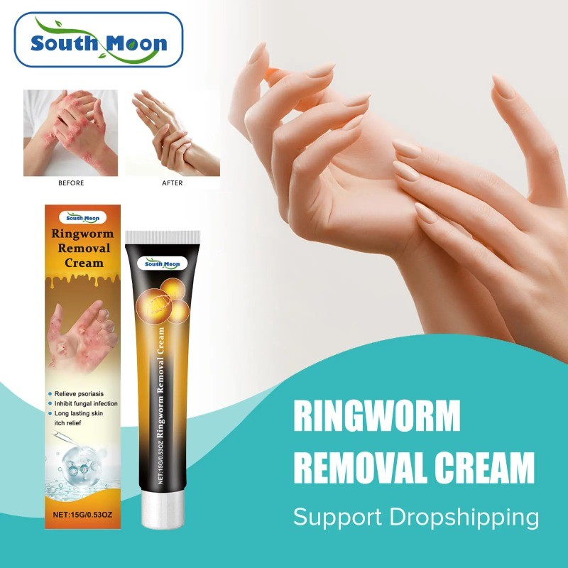 Psoriasis Antibacterial Cream Relief Urticaria Dermatitis Anti Itch ...