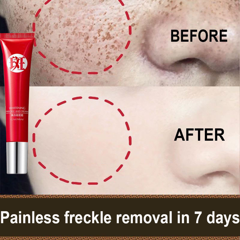 toothpaste skintific Powerful Whitening Freckle Cream Remove Melasma ...