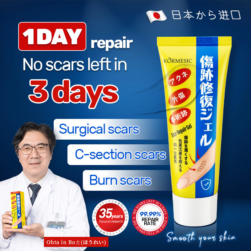 40g Scar Removal Cream Hilangkan Parut 祛疤膏 Treatment Remove Stretch ...