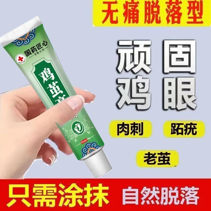 Cocoon Special Cream for Corn Eyes Foot Cocoon Thick Cocoon Corn Fleshy ...