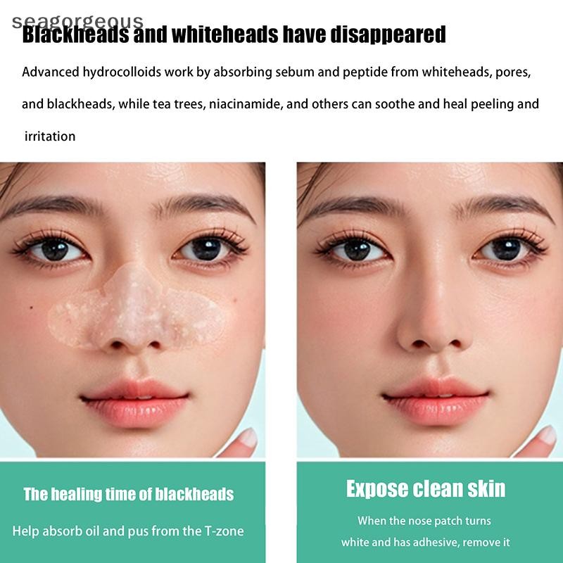 Sgmy Pimple Patches Hydrocolloid Patches T-Zone Pore Patch Forehead ...