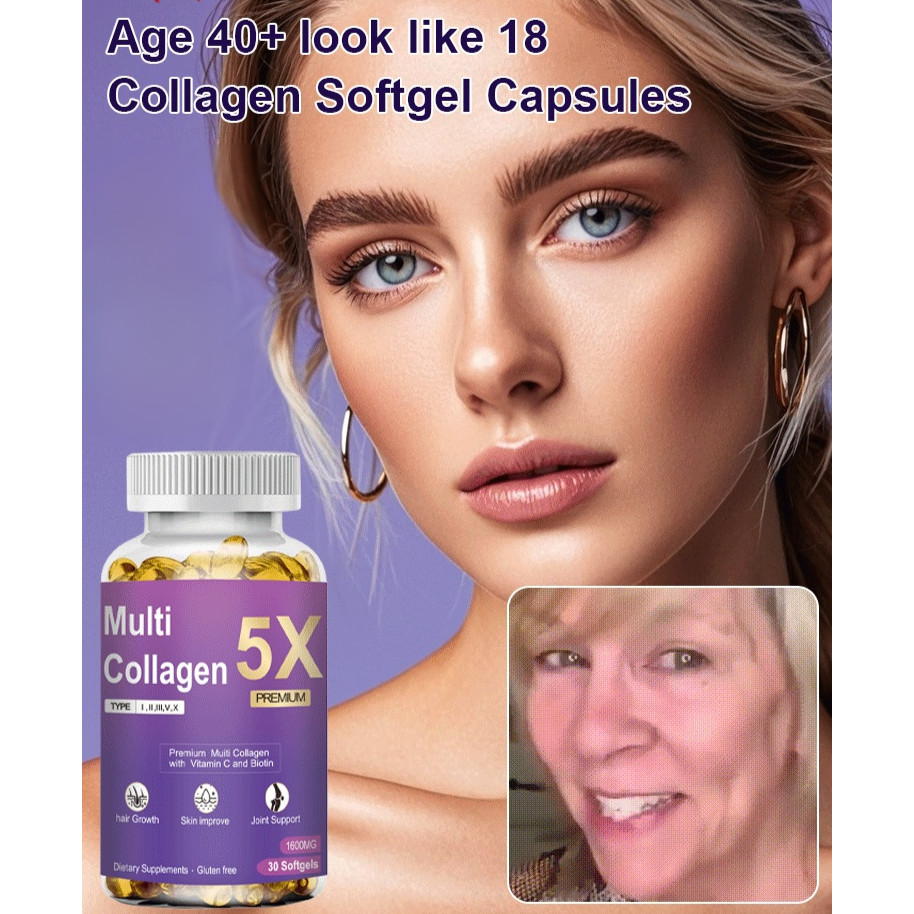 Whitening and Spot-Removing Collagen Soft Capsules,Face age Whitening ...