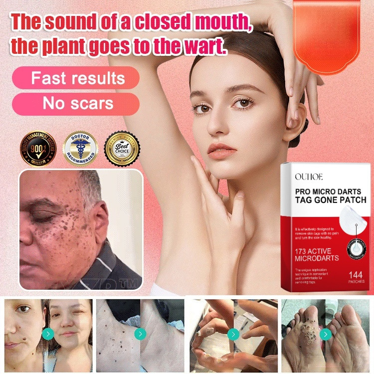 144pcs/box Wart Remover Patch/Wart Skin Tag Remover/Callus Corns ...