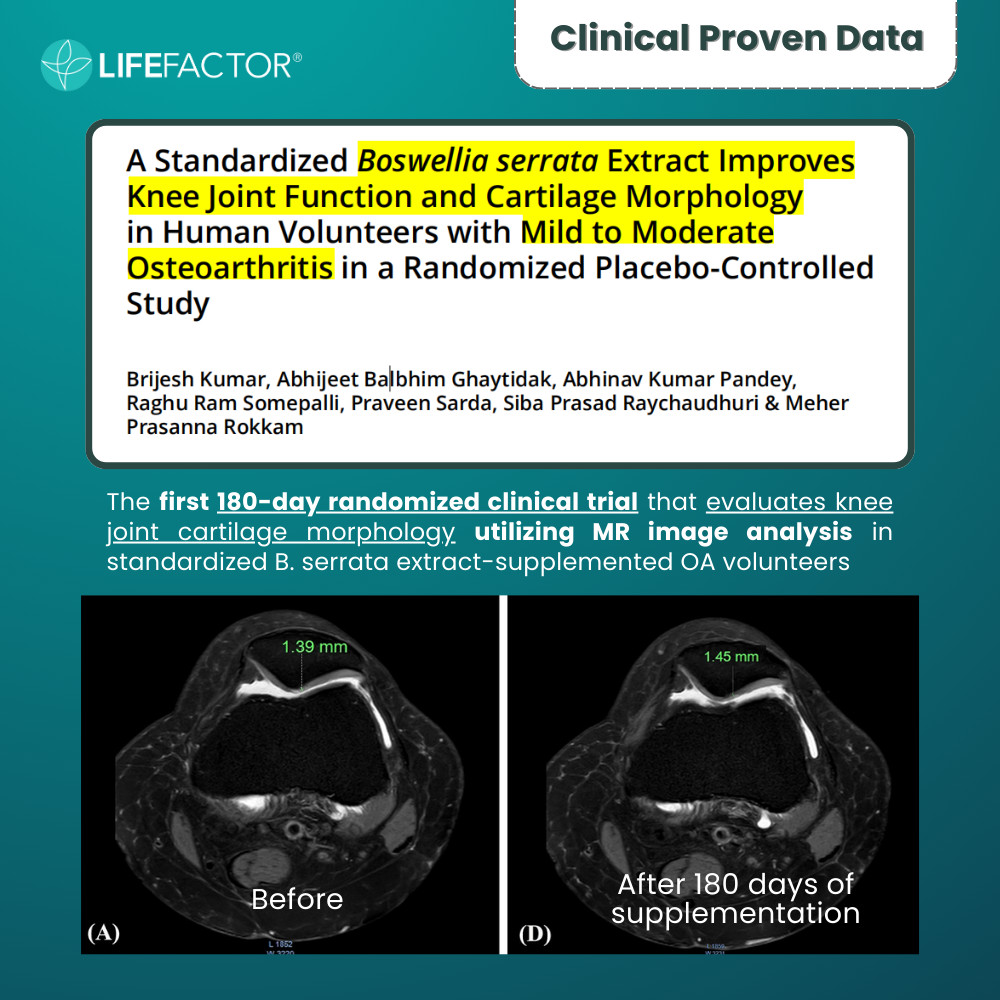 LIFE FACTOR® Truflex Clinically Proven to Relieve Joint Stiffness, Slow ...