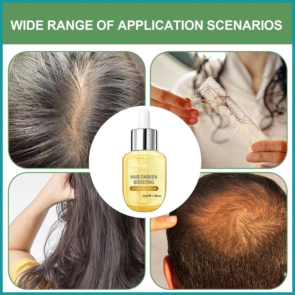 Hair Essence Oil Hair Growth Essence Supplements Oil Effective ...