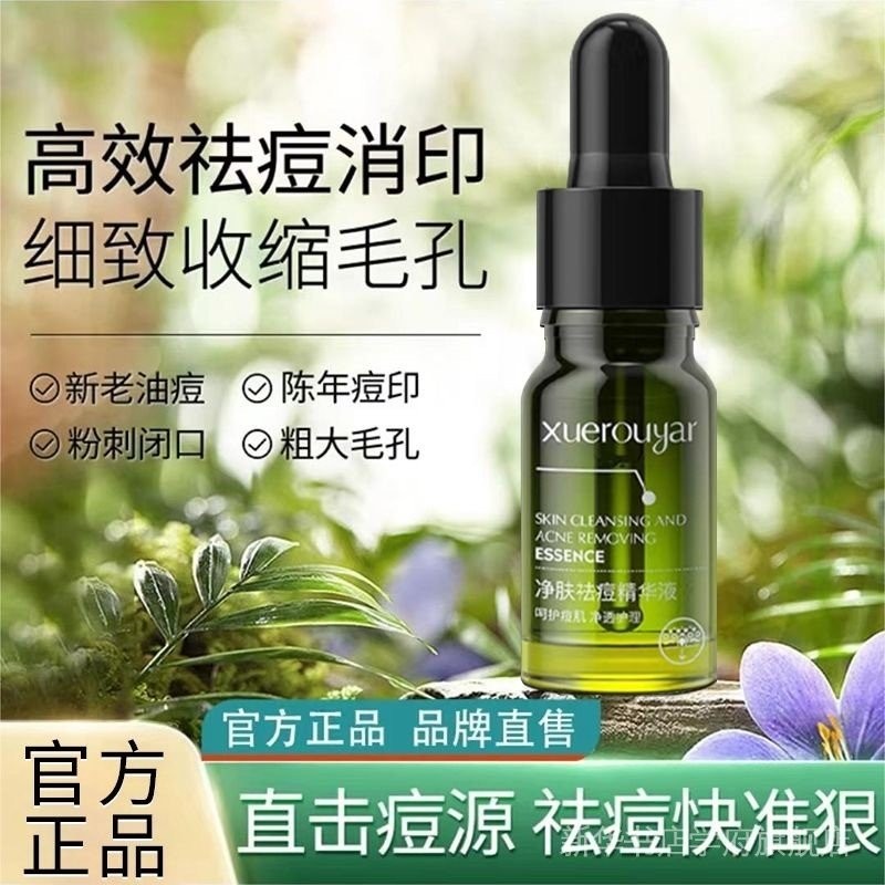 New Spot Goods 《Official Preferred Acne Removal》Anti-Acne Essence ...