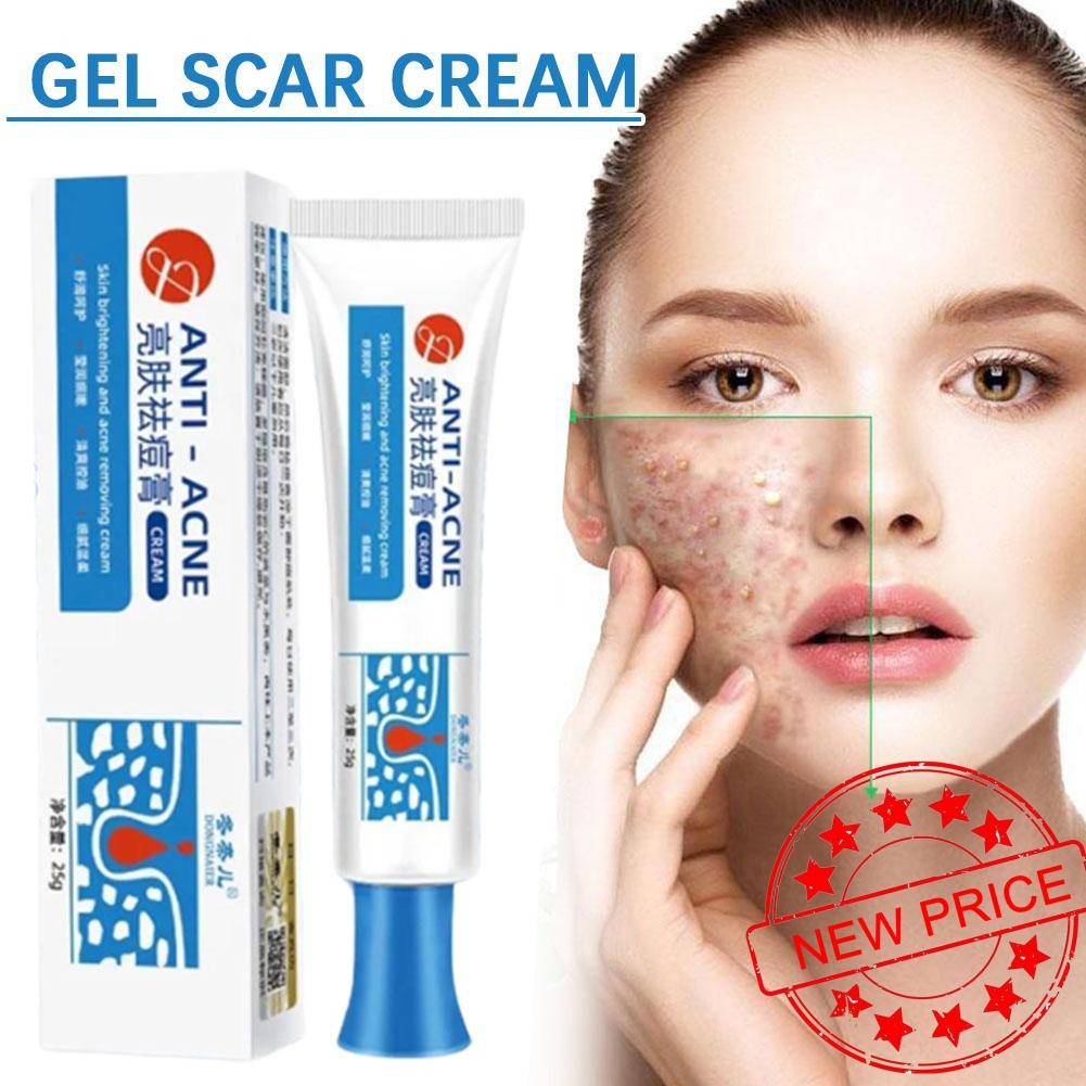 Dilute Acne Marks Skin Care Products 100% Effective Repair Cream ...