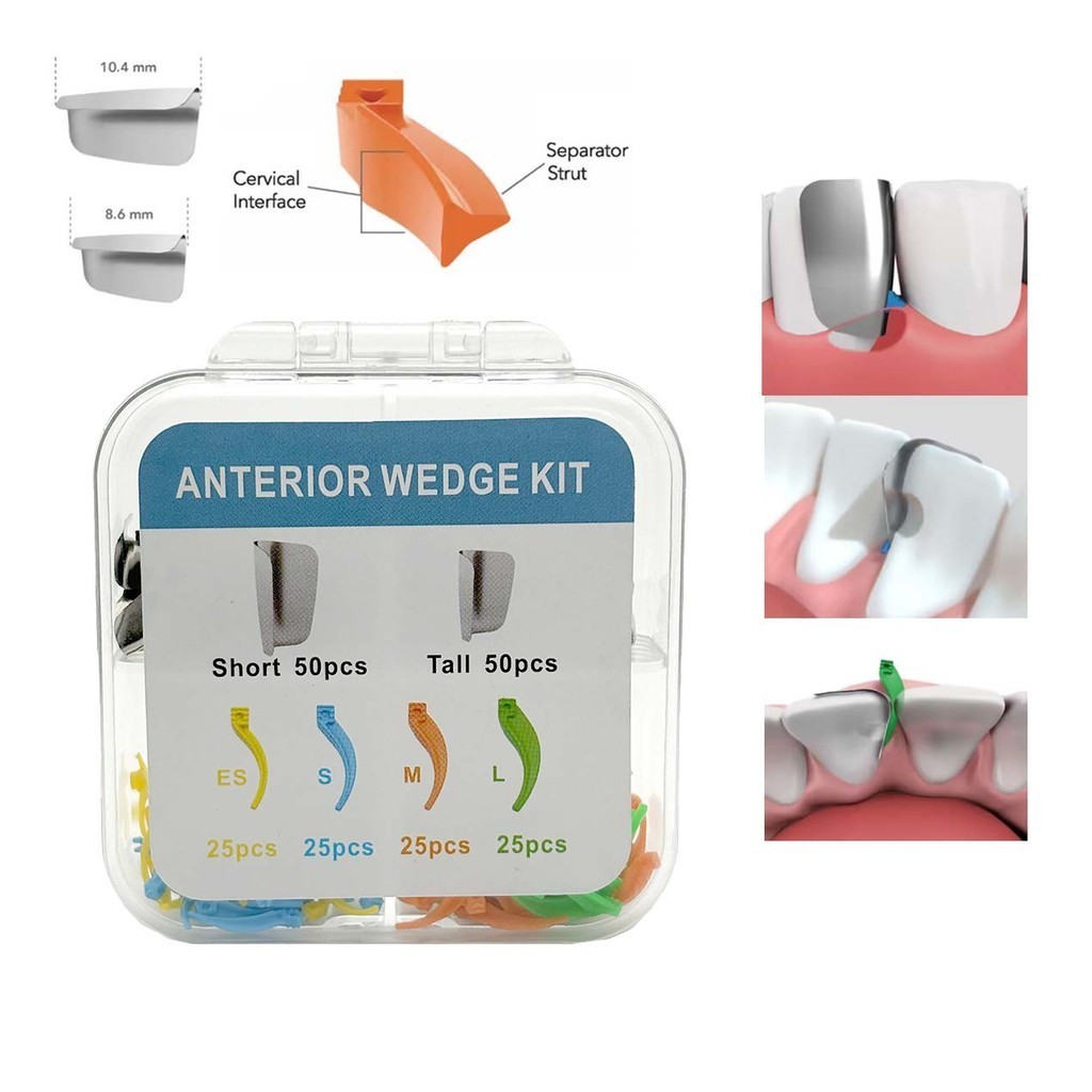 200Pcs/Set Dental Anterior Matrix System Wedge Matrix Bands Interdental ...