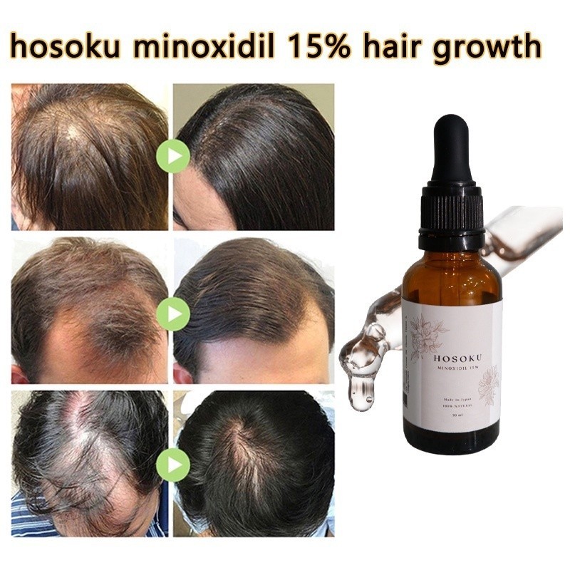 HOSOKU 15% Hair Grower with Collagen, Castrol Oil and Essential Oil ...