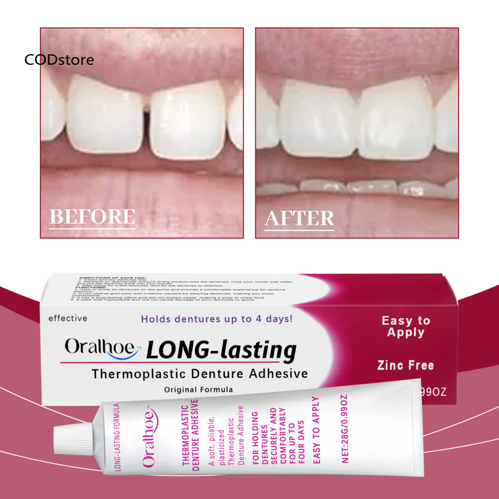 KDC Denture Adhesive Paste Loose Denture Adhesive Strong Hold Denture Adhesive Cream for Loose ...