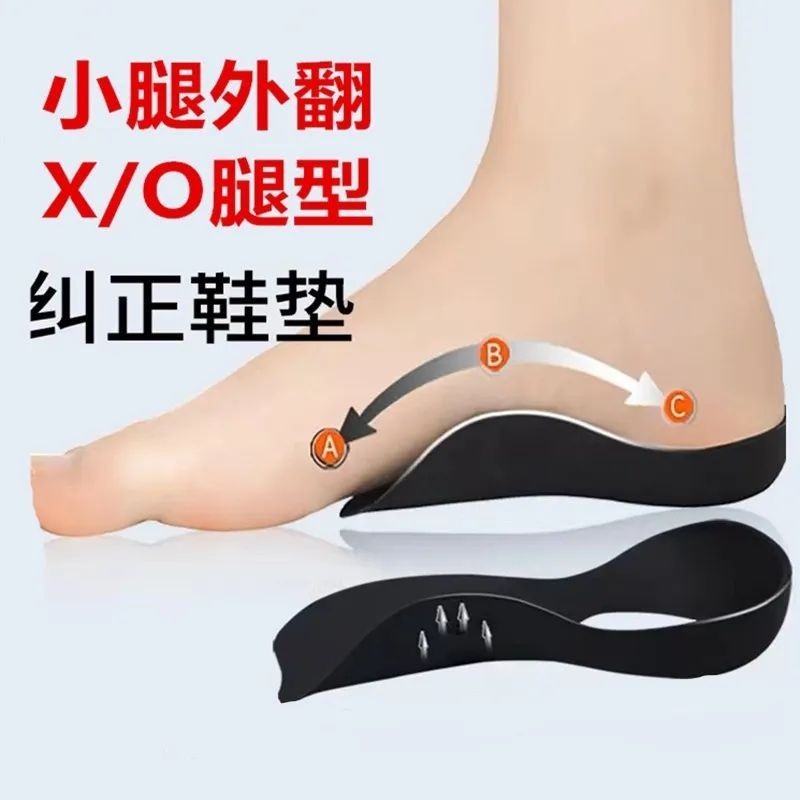 O-Shaped Leg Flat Foot Correction Insole Foot Valgus Calf Valgus ...