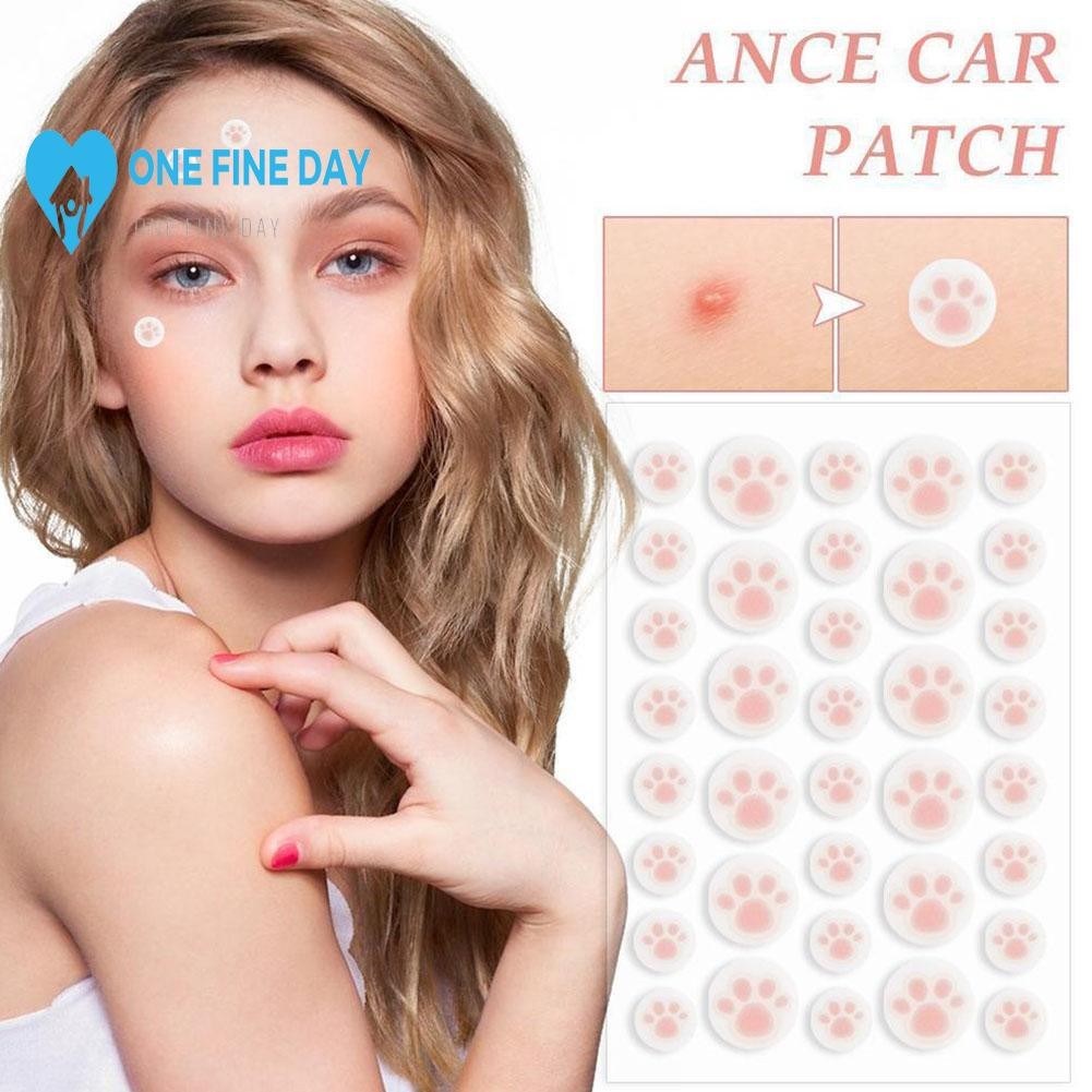 Pink Cat Paw Acne Patch Mild And Non-irritating Skin Acne Closure Fade ...