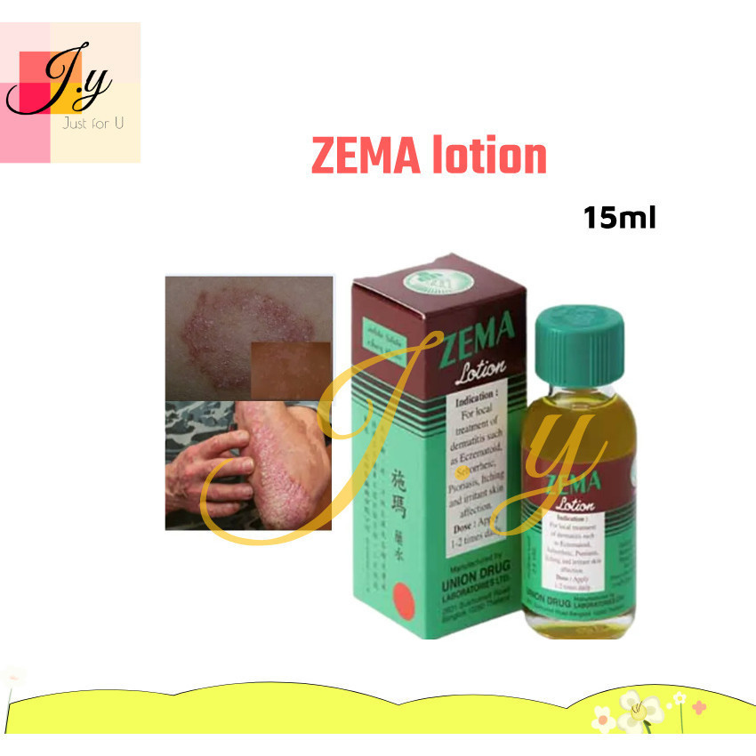 READY STOCK!!!ZEMA lotion 15ml cream 5cc Untuk Kulit Gatal Dermatitis ...
