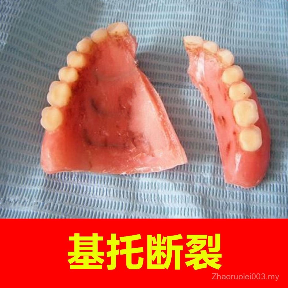 Movable Denture Glue Dentures Falling Off Sticky Teeth Broken Dentures ...