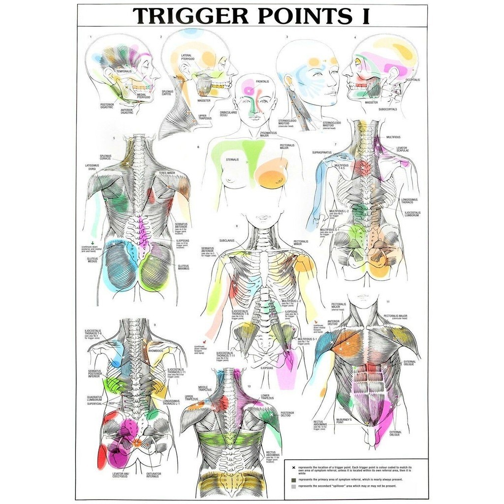 Trigger Points Chart Informational Anatomy Art Film Print Silk Poster ...
