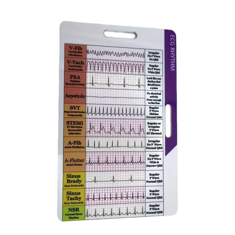[LightOverflow] ECG/EKG Rhythm Pocket Card Double Sided Design EKG ...
