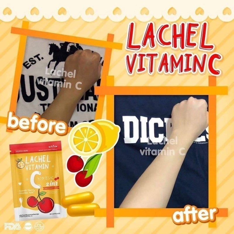 Lachel vitamin C-60capsules | Shopee Malaysia