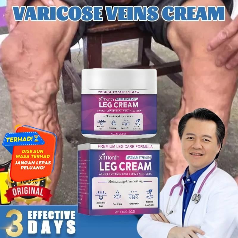 Buy 1 Get 1 Varicose Vein Cream for Phlebitis & Spider Veins - 60g Beli ...