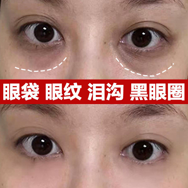 Ultrasonic Knife Eye Cream Anti-Wrinkle Firming Lightening Eye Bags ...