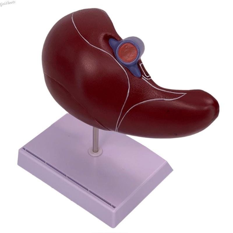 GB Anatomical Liver Model Human Liver Anatomy Model for Hospital ...