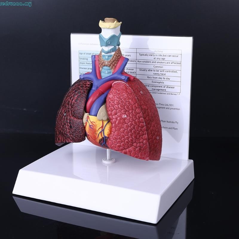 redsunaa Life Size Human Lung Model Anatomical Respiratory System ...