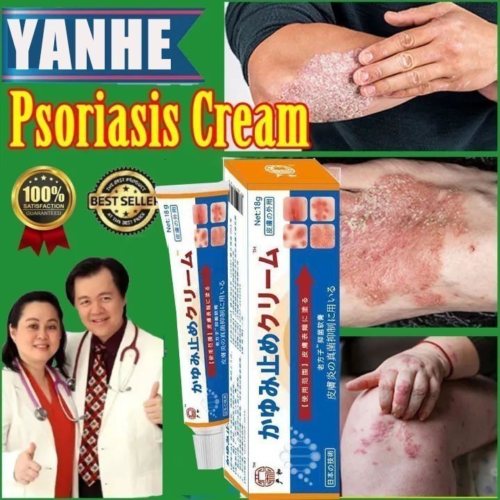 [GENUINE] Japanese Mushroom Topical Cream Herbal Ringworm Topical Cream ...