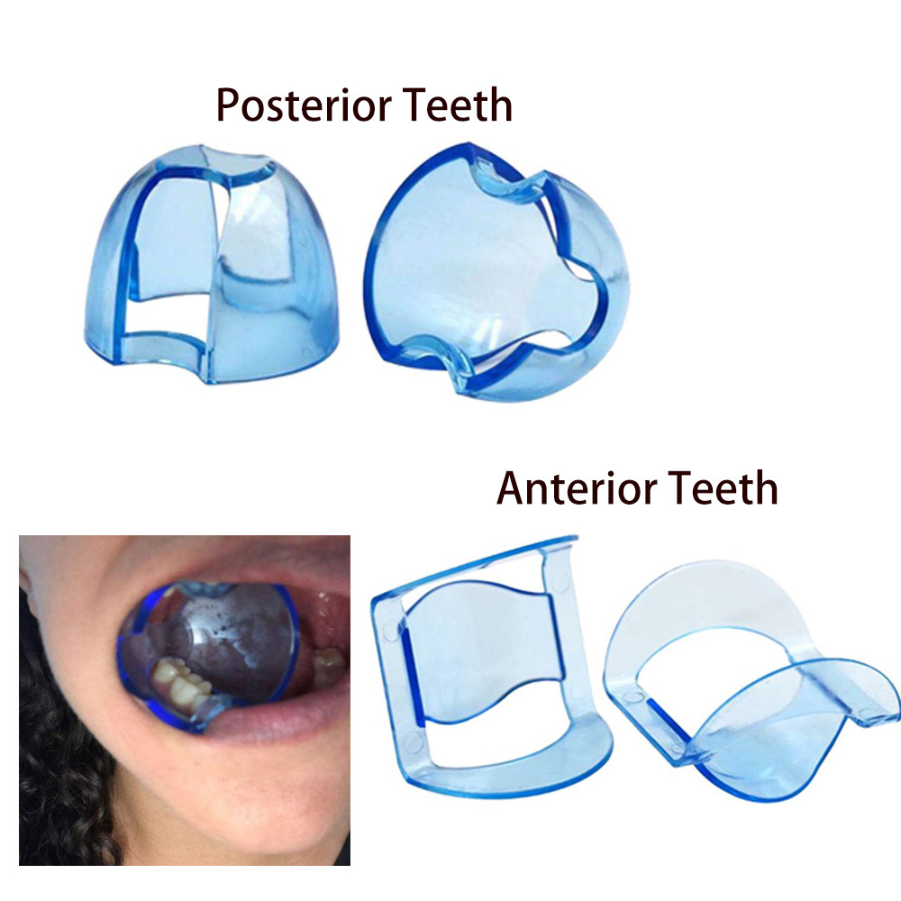 Dental Intraoral Cheek Retractor Lip Mouth Opener for Anterior ...