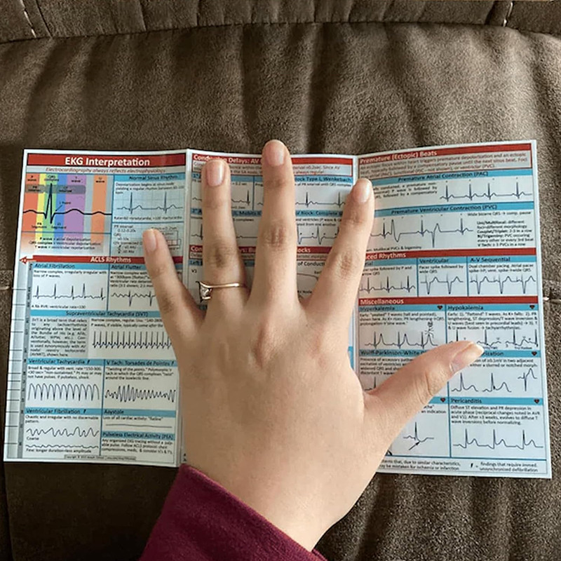 Ntmy ECG Rhythm Pocket Card for Nurses: EKG Study Guide Hospital Use ...