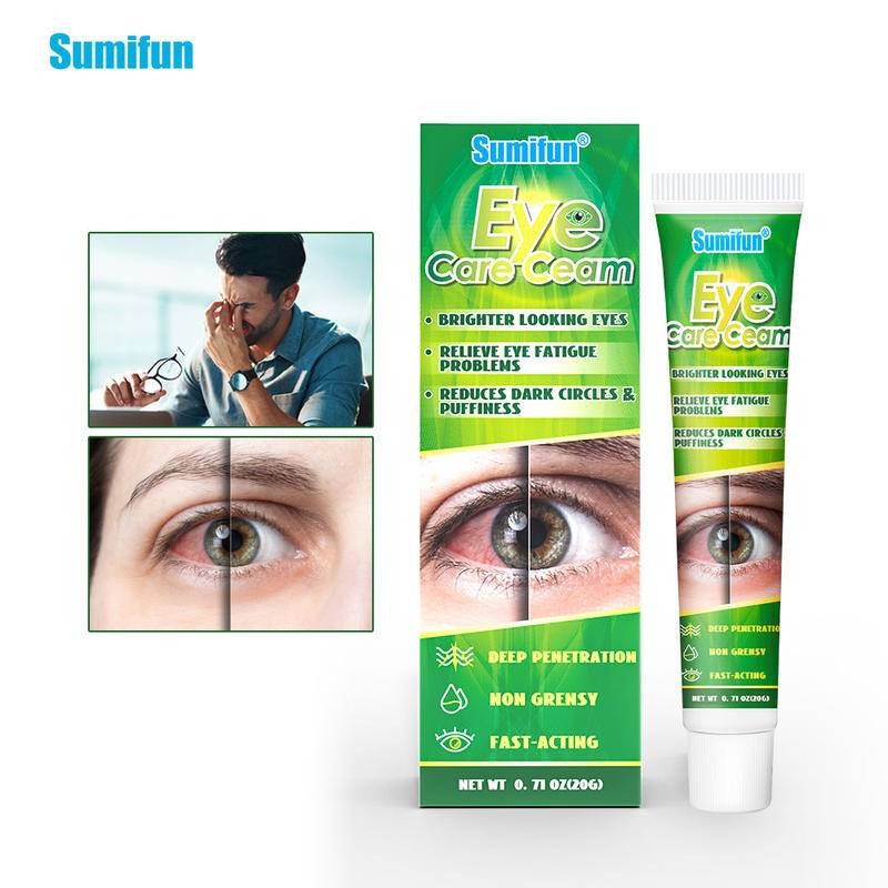 Eyes Fatigue Eye Relief Cream for Styes Chalazion Blepharitis Treatment ...