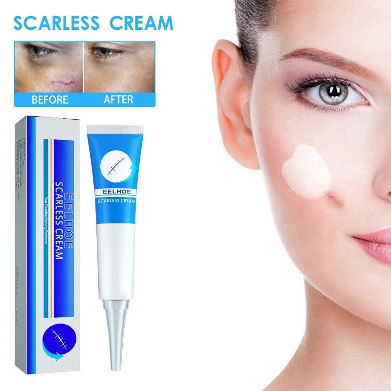 EELHOE Acne Scar Removal Cream Skin Repair Face Old Scars Keloid Burns ...