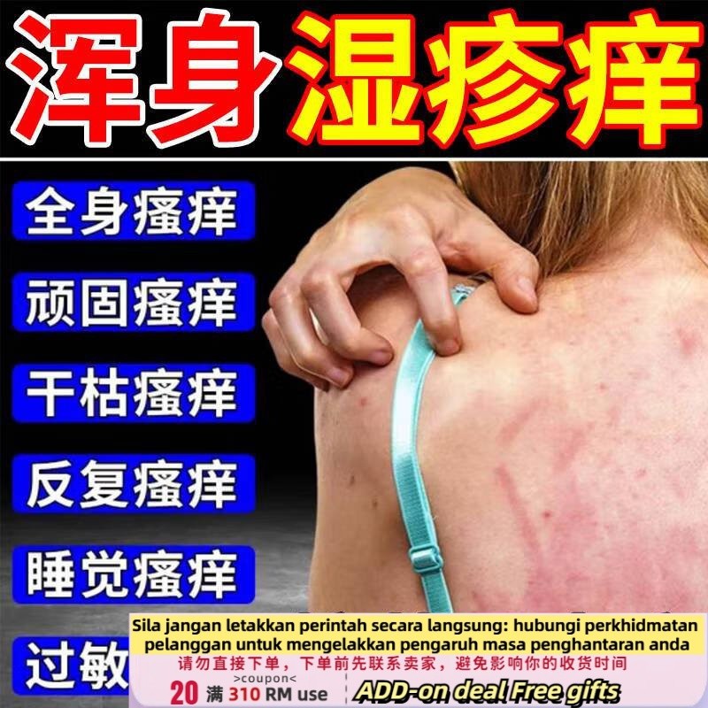 KY-JD Ointment Relieve Itching Antibacterial Skin Itching Chinese ...