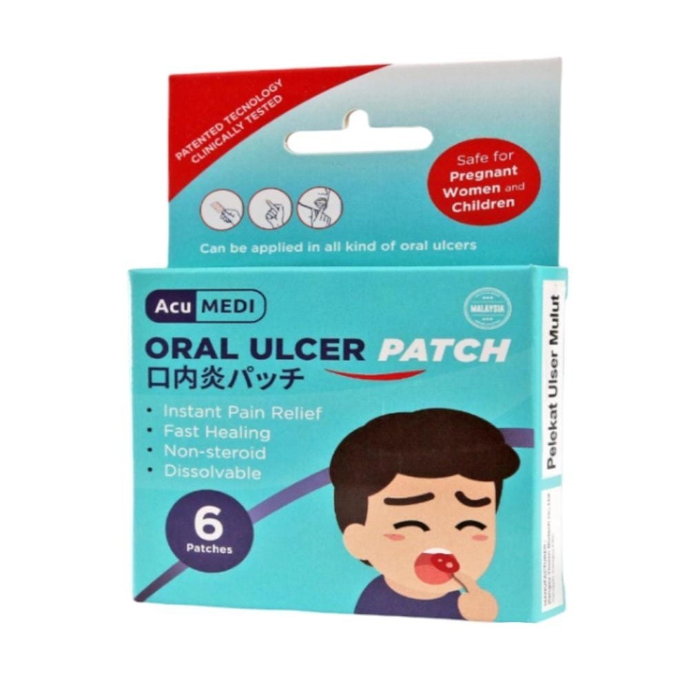 ACU MEDI ORAL ULCER PATCH 6'S (EXP: 02/2027) | Shopee Malaysia