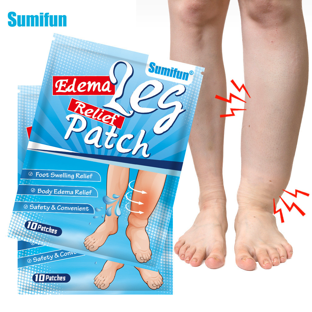 Edema Leg Relief Patch Leg swelling and foot care Patch | Shopee Malaysia