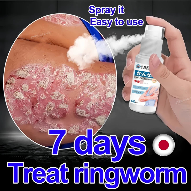 Psoriasis Eczema Spray Herbal Itch Relief Antifungal Treatment for Skin ...