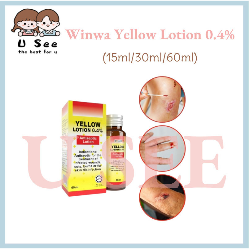 Winwa Yellow Lotion 0.4% Antiseptic Lotion Losyen Kuning Losyen ...