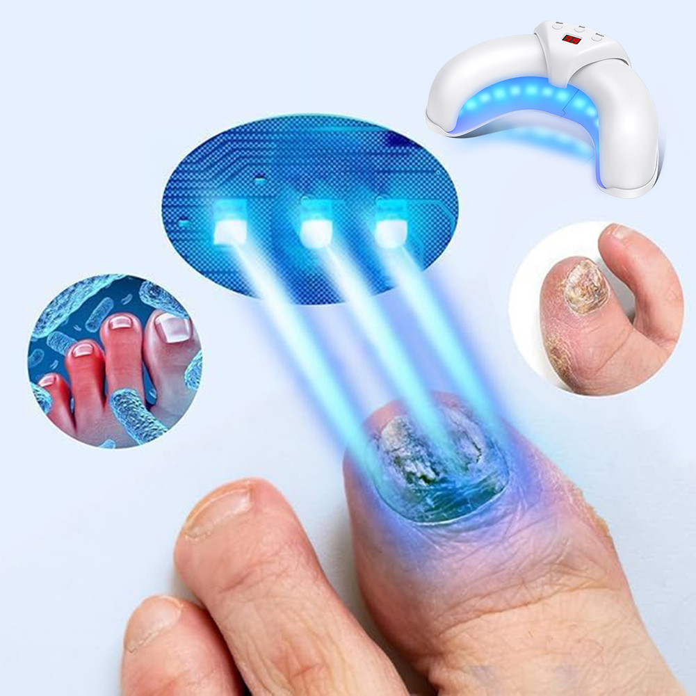 Nail Fungal Light Device Nail Fungal Cleaning Device Portable Toenail ...