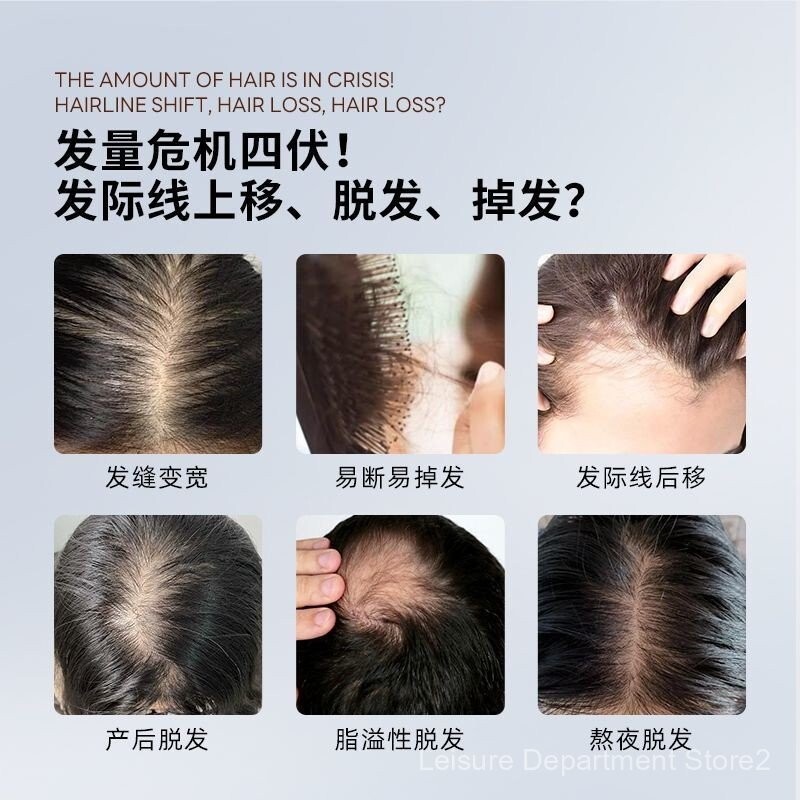 Korean Imported Anti-Hair Loss Hair Growth Serum Hair Thickening ...