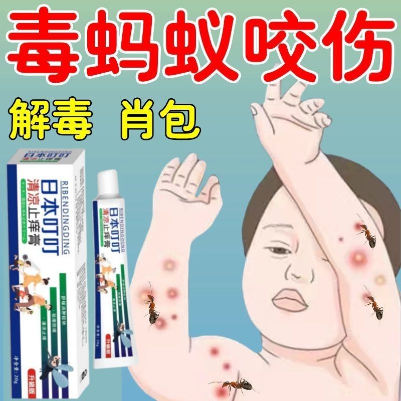 红蚂蚁咬伤脓包瘙痒止痛各种蚊虫咬伤消肿止痒专用膏Red ant bites, pustules, itching, pain relief ...