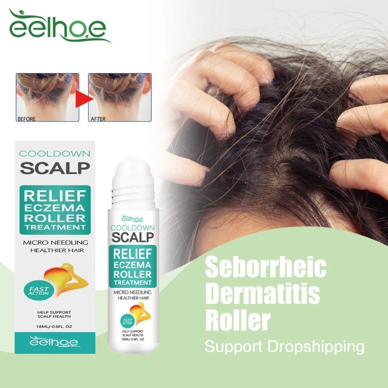 Seborrheic Dermatitis Roller Psoriasis Treatment Eliminate Eczema Scalp Moss Removal Anti ...