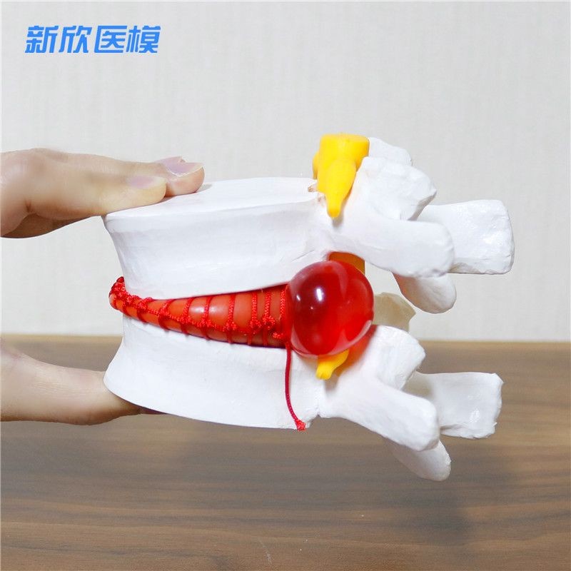 Lumbar Spine Model Spine Disc Human Body Bone Spine Column Spine ...