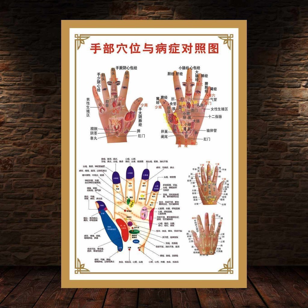 Hand Acupuncture Comparison Chart Hand Reflection Area Wall Chart Human ...