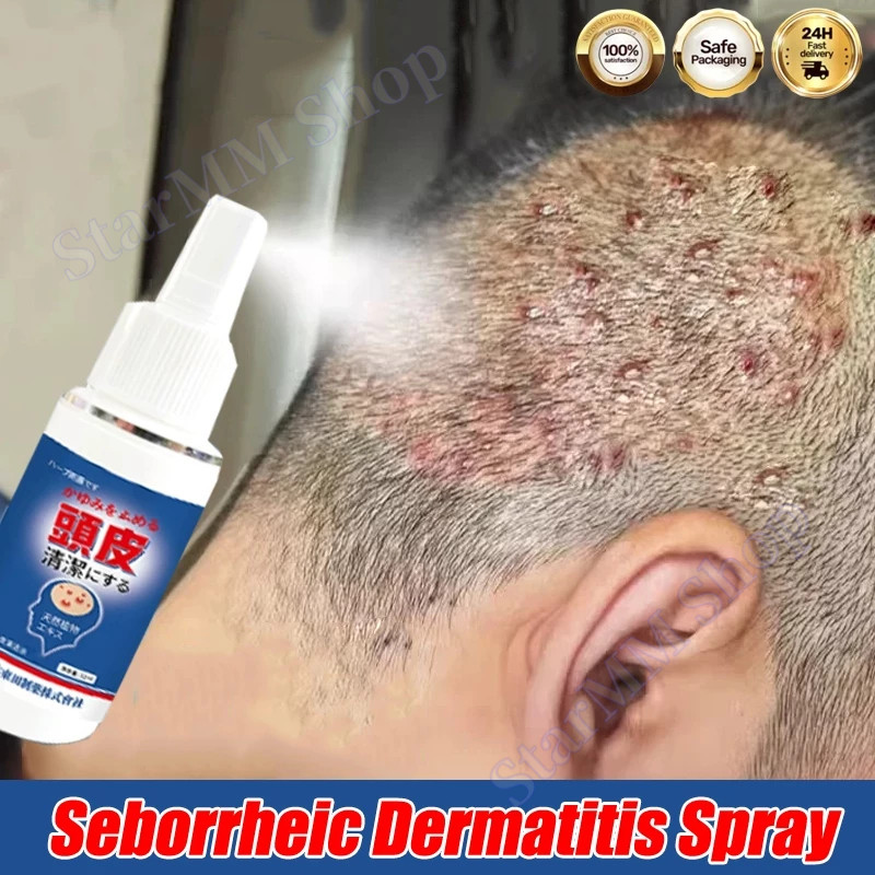 Seborrheic Dermatitis Spray 30ml Scalp Treatment Scalp Psoriasis Anti ...
