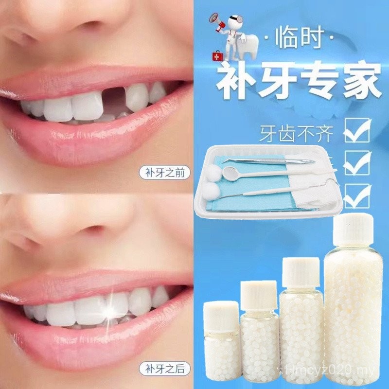 Repair Missing Teeth by Yourself False Teeth Set Front Teeth Covering ...