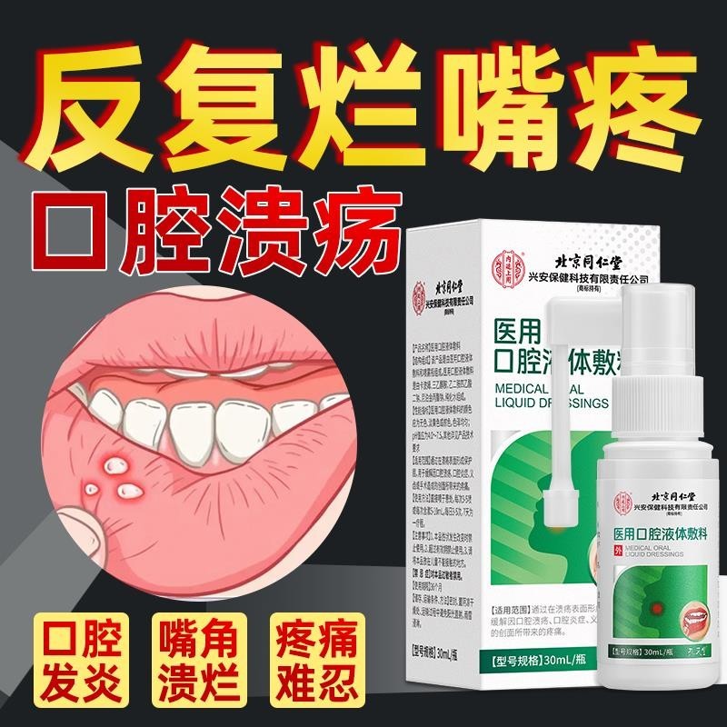 Medical Oral Spray Liquid Dressing Oral Ulcer Spray Gum Swelling Fire ...