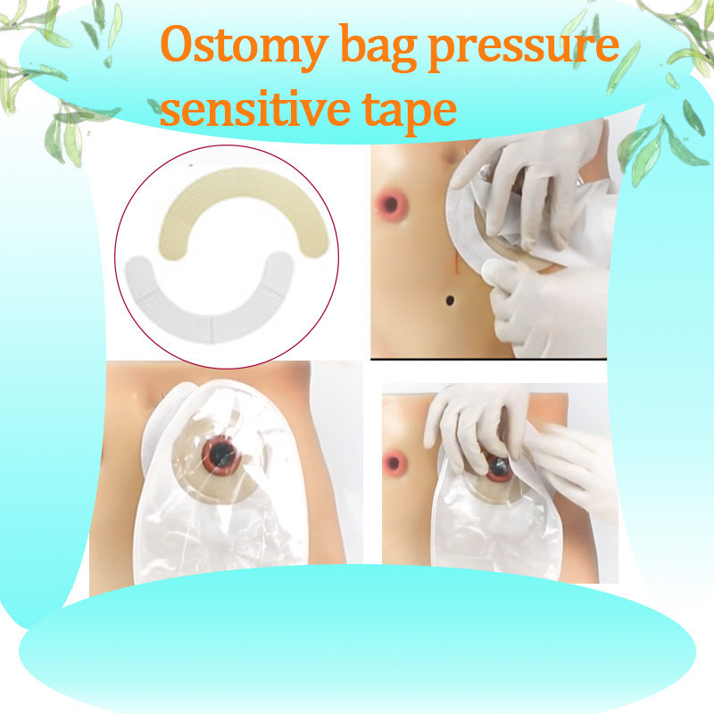 Stoma Bag Pressure Sensitive Tape Hydrocolloid Reinforced Ostomy Care ...