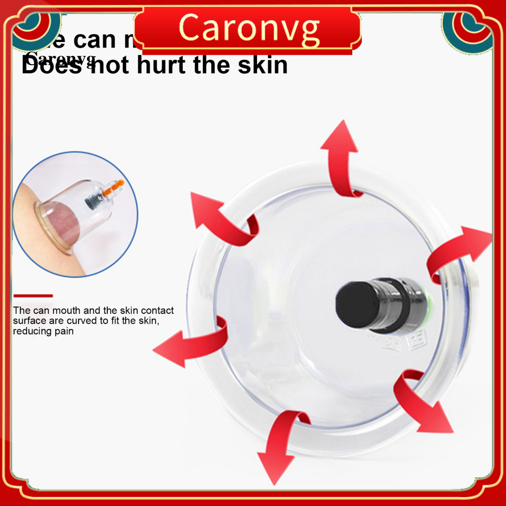 Caronvg Arm Cupping Cup Joints Cupping Cup 32pcs Cupping Therapy Kit ...