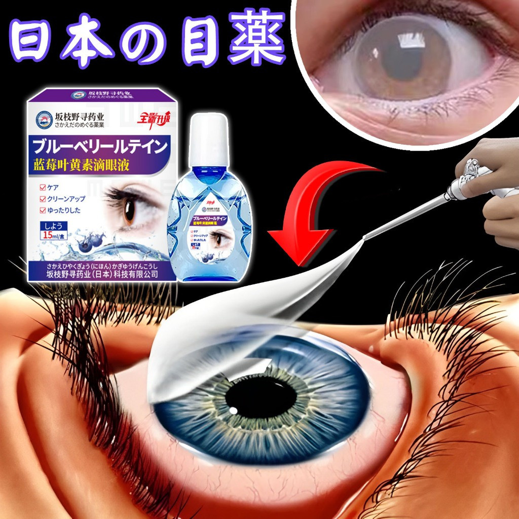 Blueberry Lutein Eye Drops 15ml Treat Cataracts-Dry Eyes Presbyopia ...